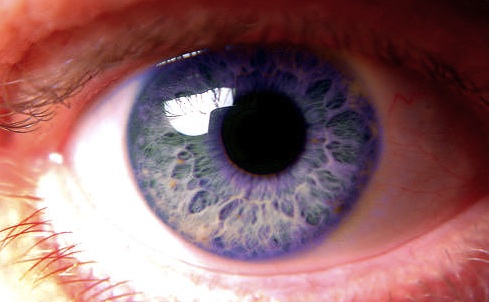 Cor dos olhos - DicasFree.com